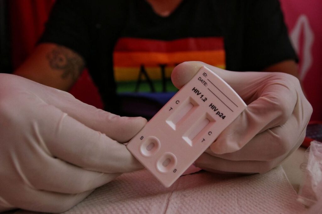 Día Mundial del Sida 2025: Indetectable=Intransmisible y los avances ...